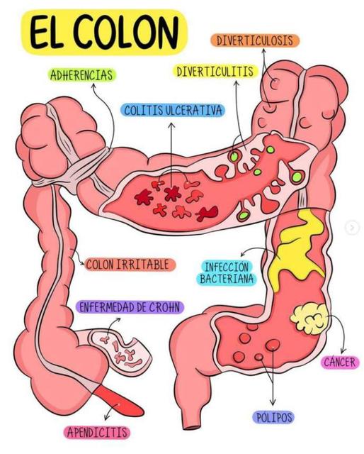 El colon | YUDOC.ORG | uDocz