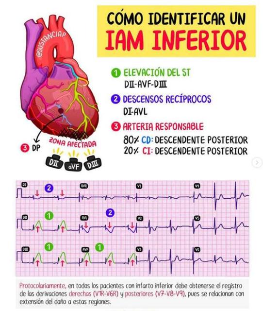 Identificar un IAM Inferior | YUDOC.ORG | uDocz