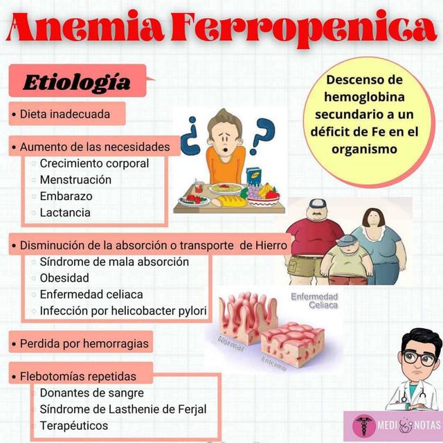 Anemia Ferropenica | YUDOC.ORG | uDocz