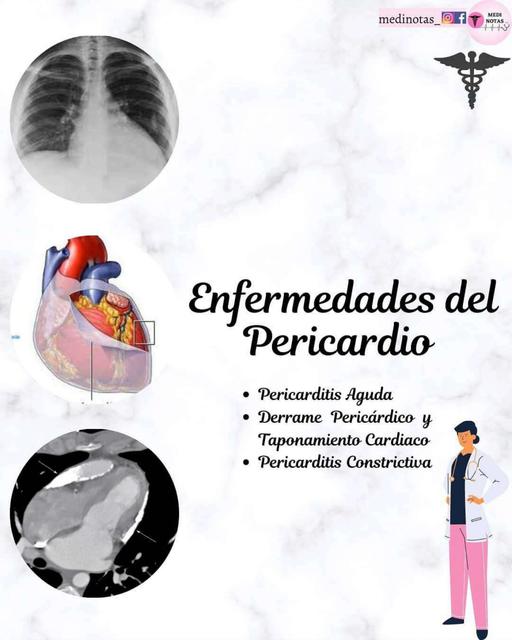 Enfermedades del Pericardio | YUDOC.ORG | uDocz