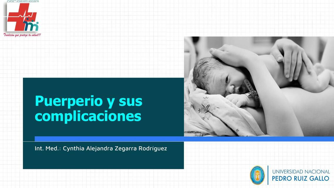 Puerperio y sus complicaciones | Alejandra Zegarra | uDocz