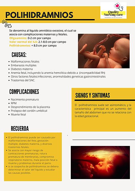 Polihidramnios | Medicina humana | Enfermedades | uDocz Polihidramnios | Medicina humana | Enfermedades | uDocz