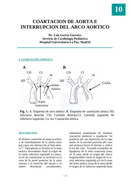 Aorta y sus venas. Coartación de aorta e interrupción del arco aórtico ...