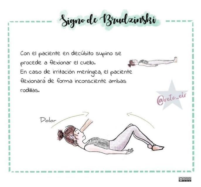 Signo de Brudzinski | YUDOC.ORG | uDocz