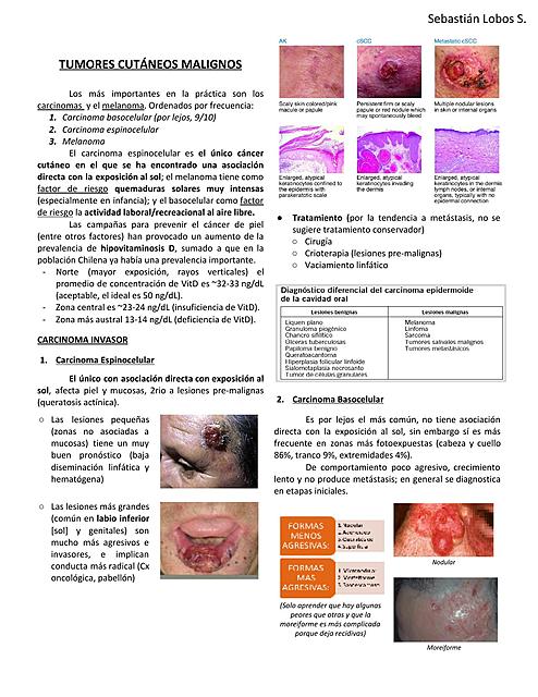 Resumen Sobre Tumores Cutáneos Malignos (Dermatología) | Apuntes ... Resumen Sobre Tumores Cutáneos Malignos (Dermatología) | Apuntes ...