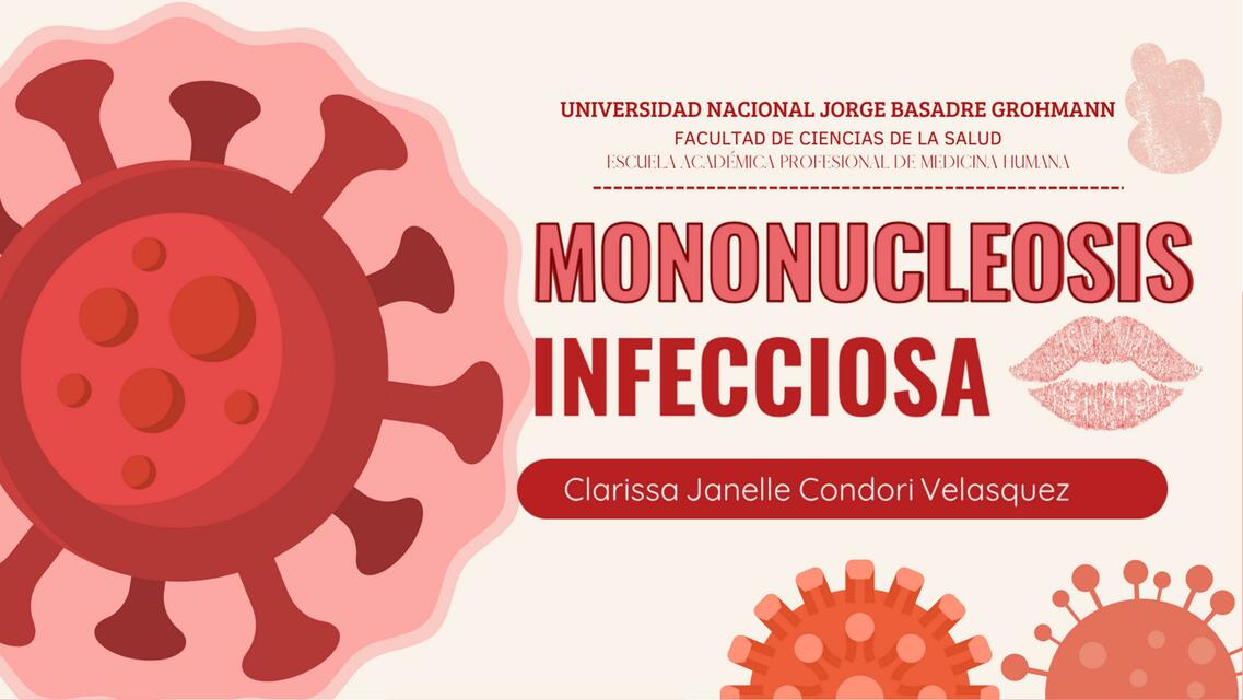 Mononucleosis Infecciosa | Clarissa Janelle Condori Velásquez | uDocz