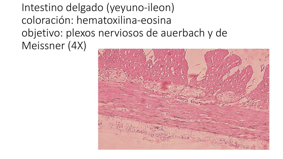 Laminas polimorfismos de nucleótido único | Angeles Tataje | uDocz
