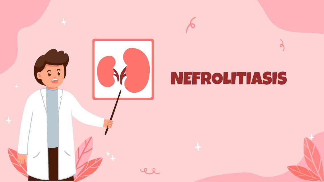 Litiasis renal | Lupita | uDocz