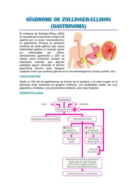 Síndrome de zollinger | Lilibeth Zambrano | uDocz