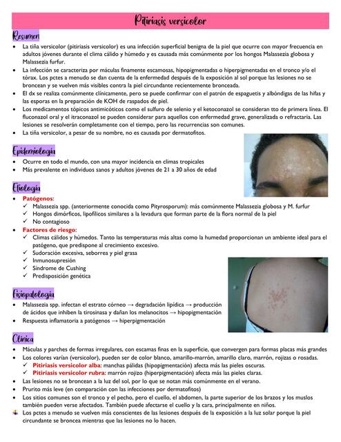 Pitiriasis versicolor | Jess | uDocz