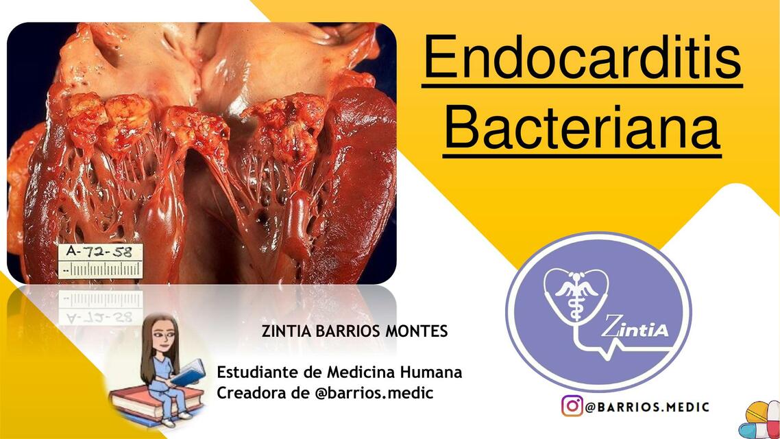 Resúmenes de Endocarditis aguda | Descarga apuntes de Endocarditis aguda