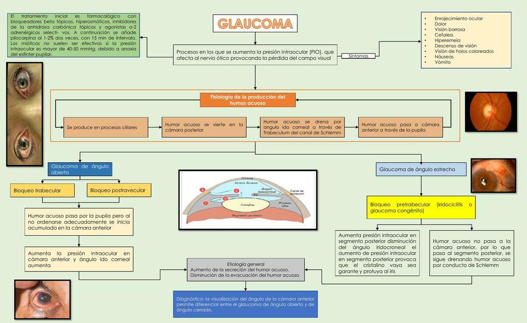 Glaucoma | Ricardo Hernández | uDocz