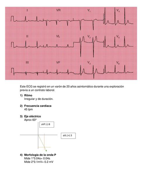 ECG 2 | Chemnotes by DM. | uDocz