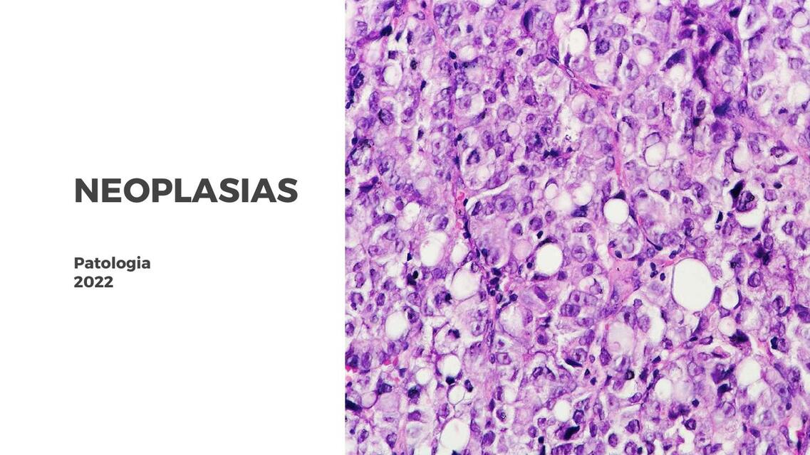 Neoplasias | Mariana Juárez Recinos | uDocz