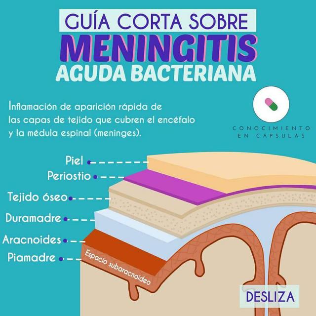 Meningitis Bacteriana Aguda | YUDOC.ORG | uDocz
