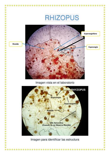 Microscopia : Rhizopus, aspergillus y fusarium | RESÚMENES MÉDICOS | uDocz