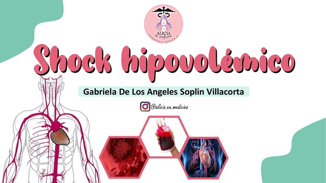 Shock Hipovolémico | Alicia en Medicina by Gabriela Soplin Villacorta ...