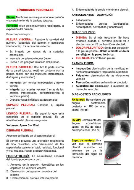 Sindromes pleurales | MEDICAL NOTES | uDocz