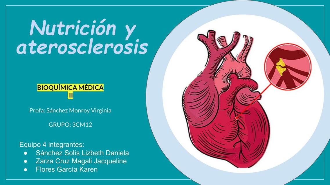 Nutrición y Aterosclerosis | Magali Zarza | uDocz