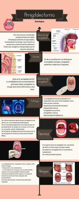 Amigdalectomía | Jesus_G_Moreno_M | uDocz
