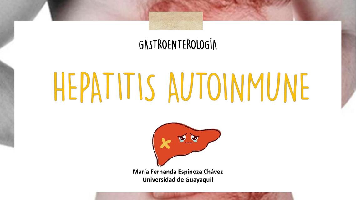 Hepatitis autoinmune - Gastroenterología | MIS APUNTES MEDICOS | uDocz