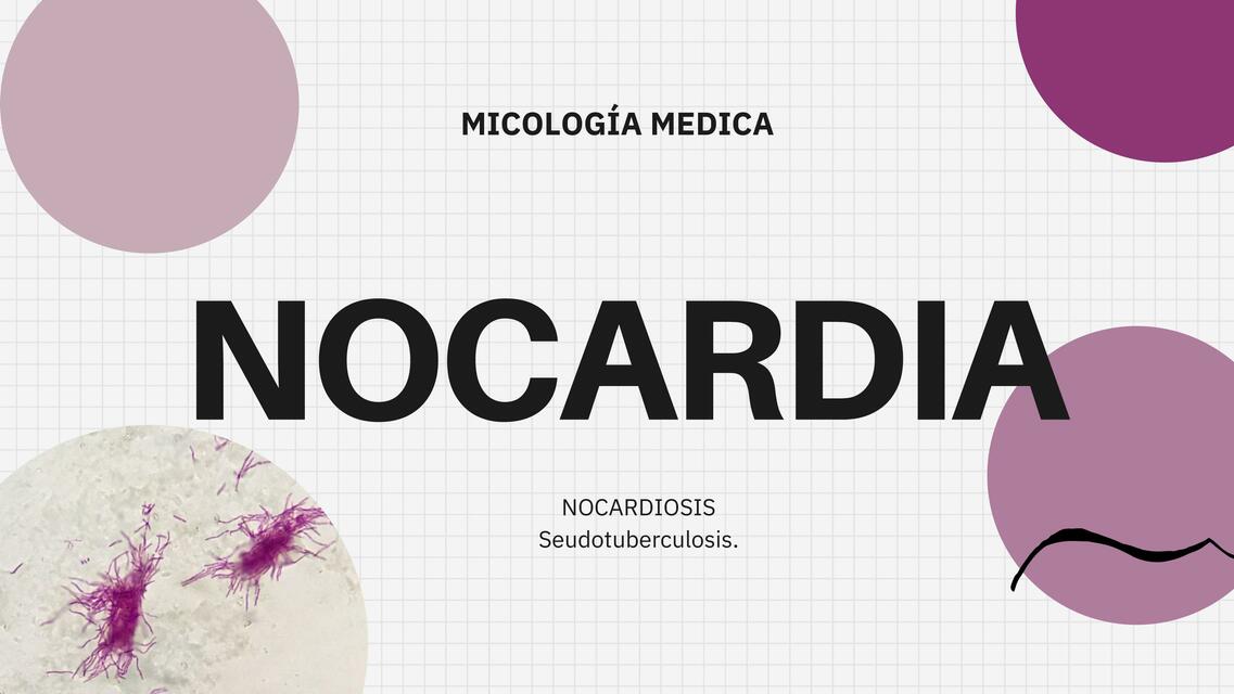 Nocardia | Arlette Saldaña Salas | uDocz