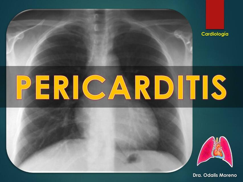 🫀 Pericarditis 🫀 - Cardiología ♥️ | Dra Odalis Moreno | uDocz