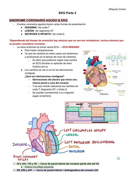 Electrocardiograma 2 | MEDilove | uDocz
