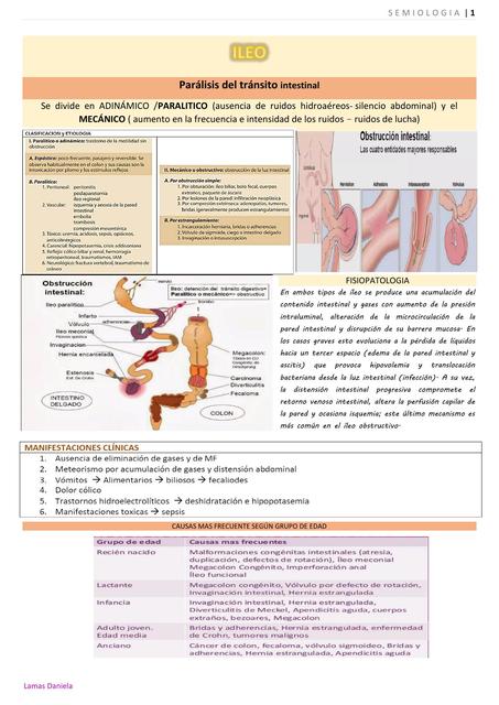 Parálisis del tránsito intestinal | daniela lamas | uDocz