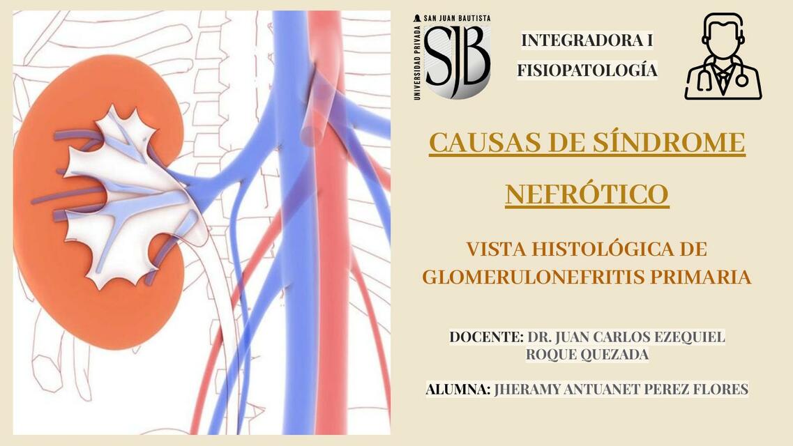 Causas de Síndrome Nefrótico | Antuanet J.P Pérez | uDocz