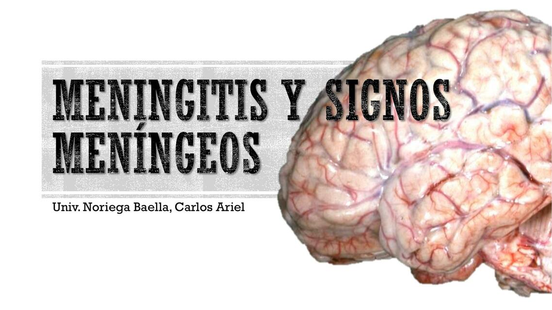Resúmenes de Signos meningeos | Descarga apuntes de Signos meningeos