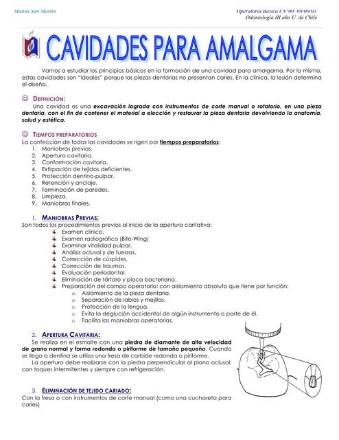 Cavidades para Amalgama | YUDOC.ORG | uDocz
