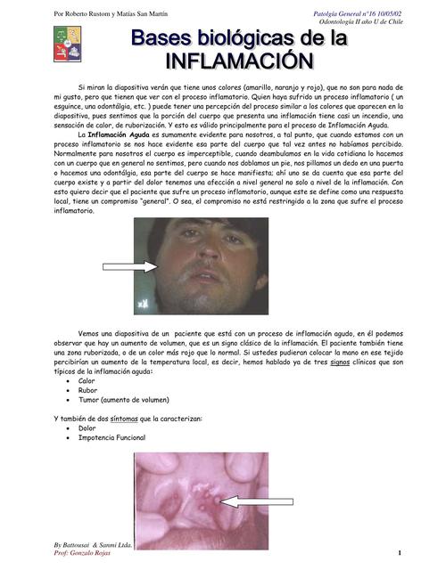bases Biológicas de la Inflamación | YUDOC.ORG | uDocz
