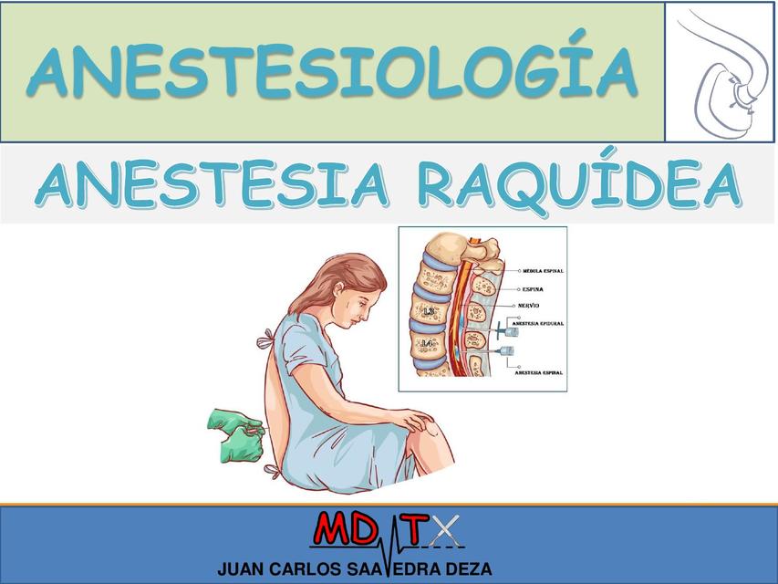 DATOS BÁSICOS SOBRE ANESTESIA RAQUÍDEA | CARLOS_MDTXPE | uDocz