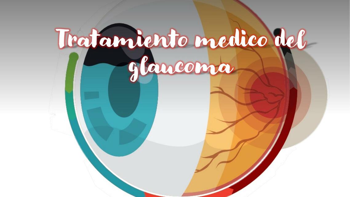 Tratamiento de Glaucoma | Celina Martinez | uDocz