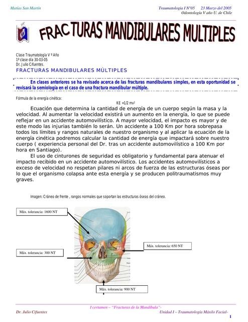 Resúmenes de Fracturas mandibulares | Descarga apuntes de Fracturas ...