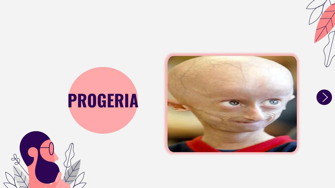 Progeria | Alejandra Salazar | uDocz