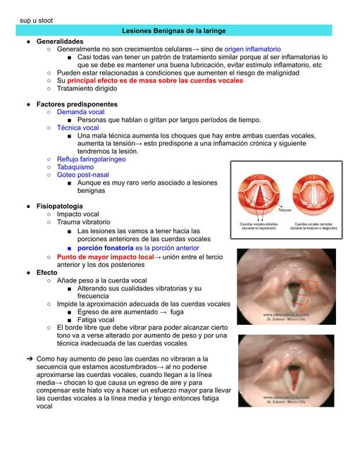 Lesiones benignas de la laringe | MEDilove | uDocz