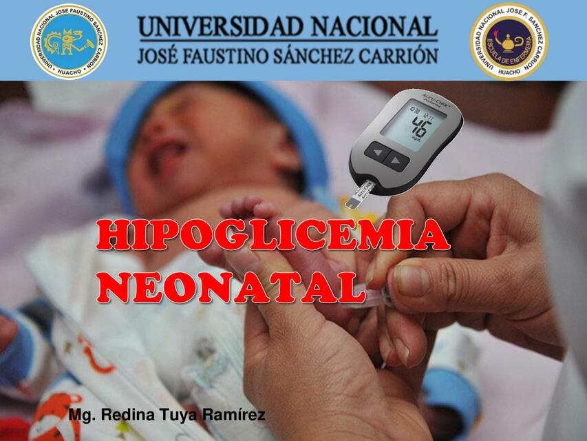 Hipoglicemia neonatal | BARRÓN MARTINEZ JENNIFER | uDocz