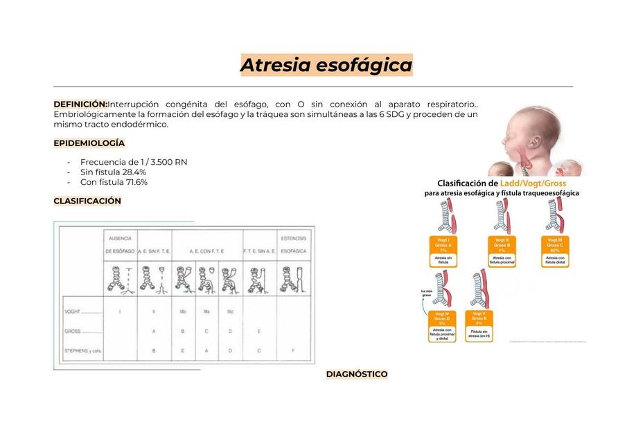 Atresia esofágica | Angela Dominguez | uDocz Atresia esofágica | Angela Dominguez | uDocz