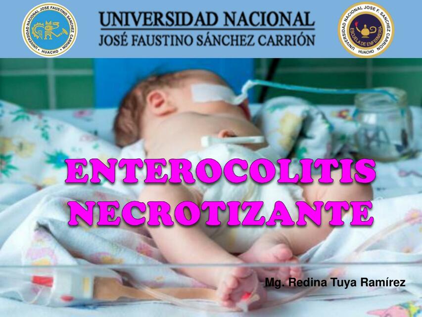Enterocolitis Necrotizante | BARRÓN MARTINEZ JENNIFER | uDocz Enterocolitis Necrotizante | BARRÓN MARTINEZ JENNIFER | uDocz