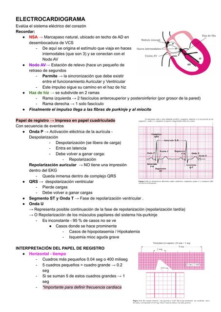 Electrocardiograma | MEDilove | uDocz