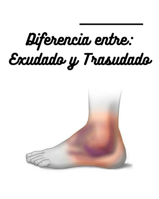Diferencia entre Exudado y Trasudado | medi_fer | uDocz