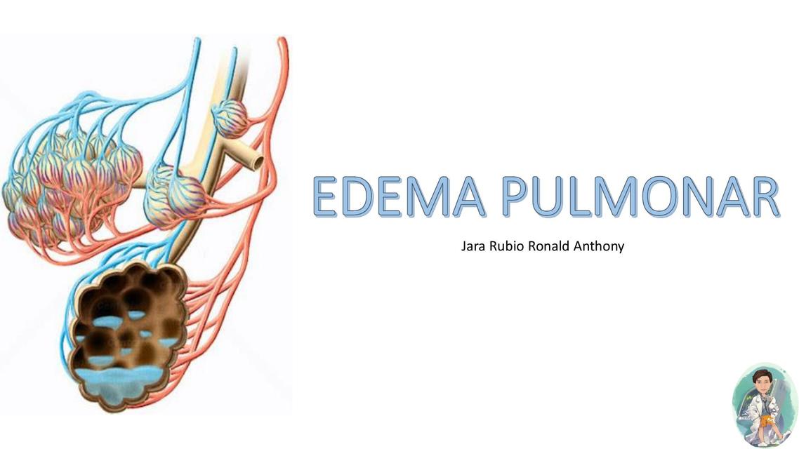 EDEMA PULMONAR | dx.allmed | uDocz