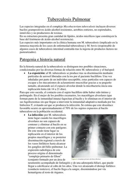 Tuberculosis Pulmonar y Extrapulmonar | Andrés Cataldi | uDocz