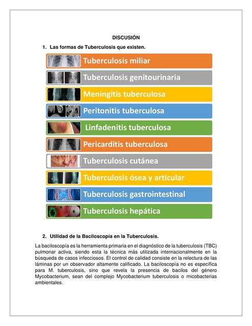 Tuberculosis pulmonar | Rocío Rodríguez | uDocz