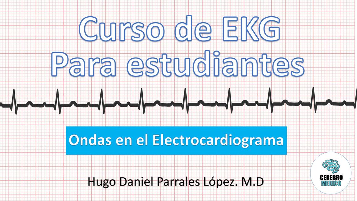 Ondas en el ekg | Felisa Ivania Gomez Garcia | uDocz