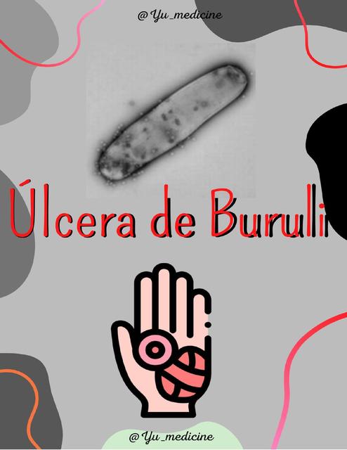 Ulcera de Buruli | YU_MEDICINE | uDocz