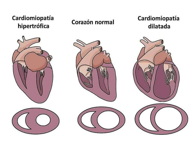 Alteraciones en la estructura del corazón | fraii | uDocz