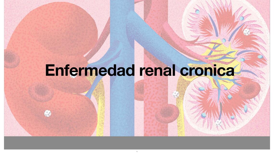 Enfermedad Renal Crónica | uDocz
